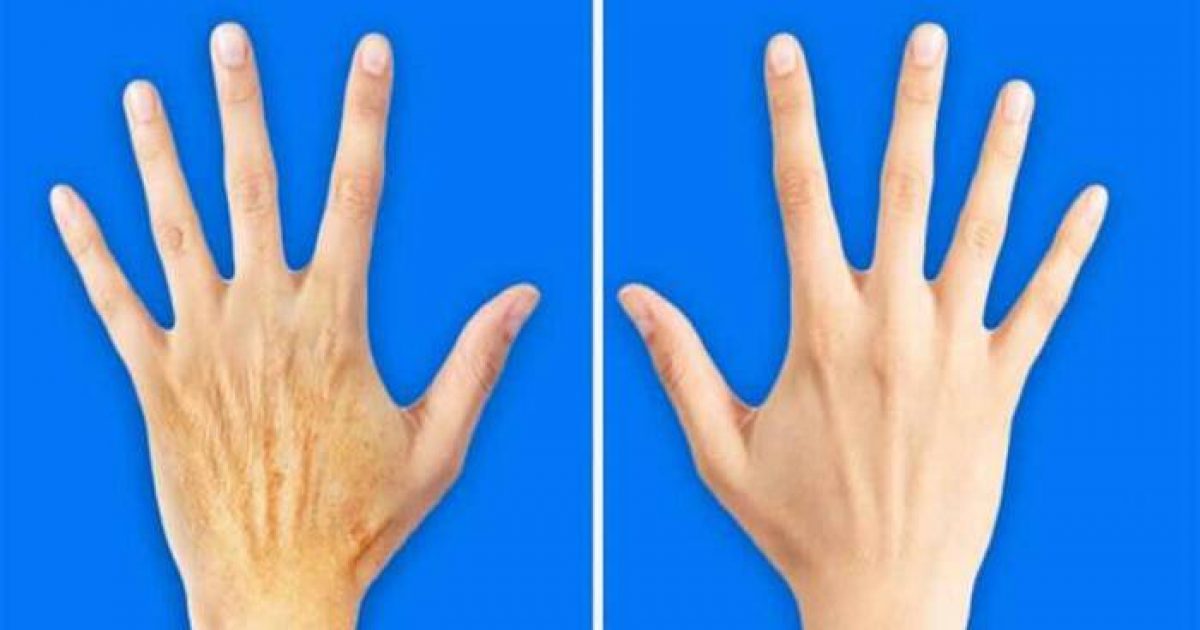 5 μυστικά για να κάνετε τα χέρια σας 10 χρόνια νεώτερα | CityPatras