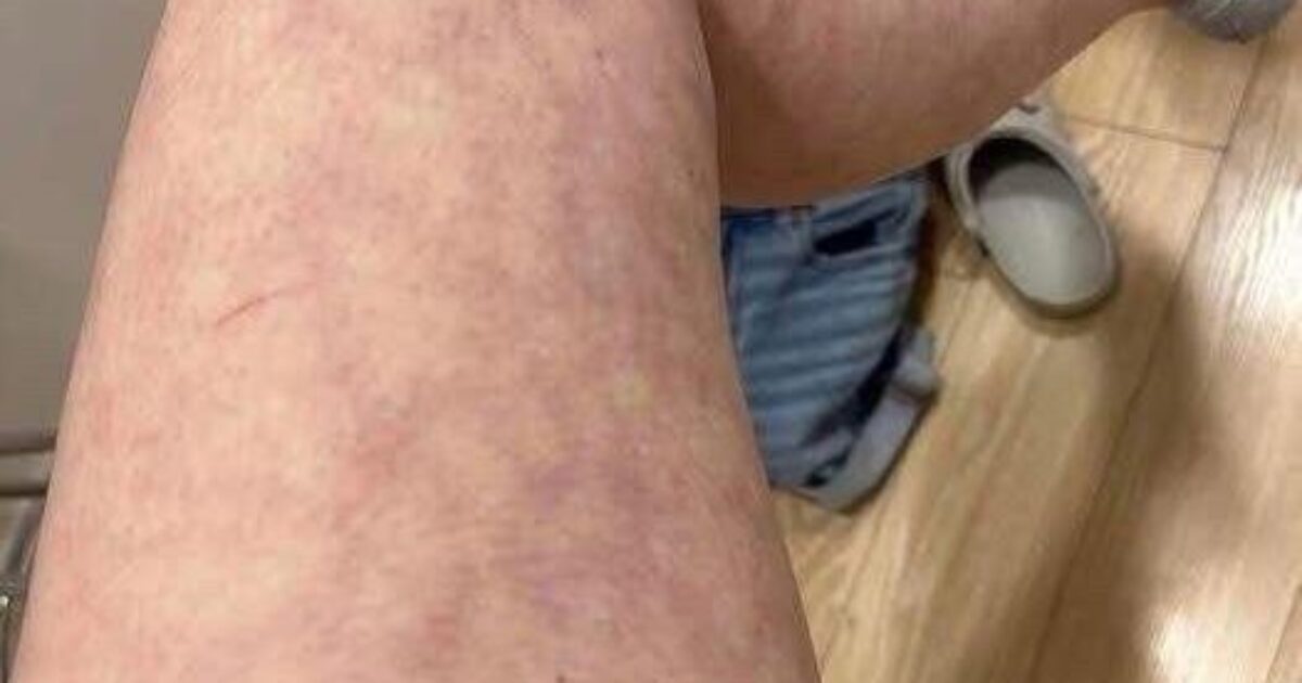 Αυτές είναι οι συνέπειες να κοιμάσαι με.. | CityPatras